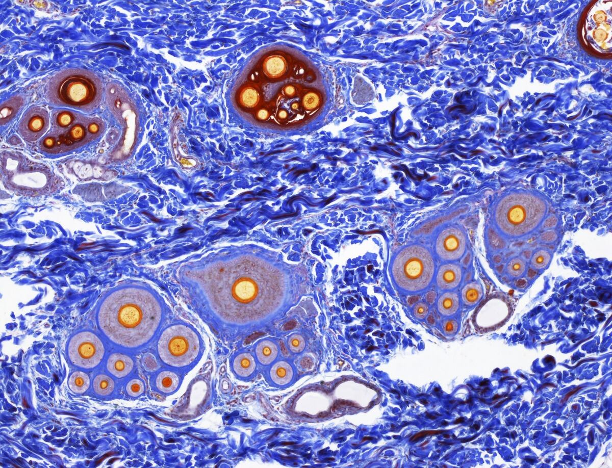 'Atlas de la Célula Humana' ayudará a entender y combatir enfermedades ...
