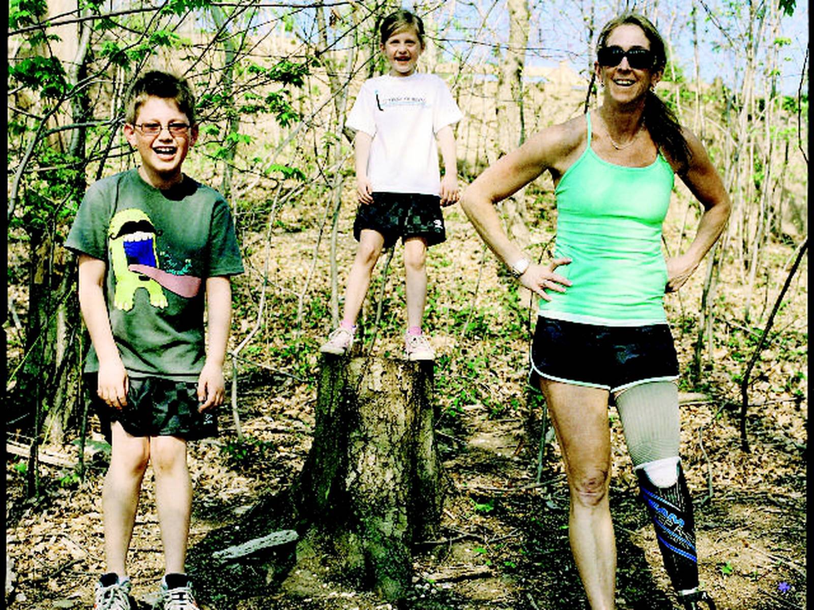 Innovadoras prótesis transforman la vida de personas amputadas | La Nación