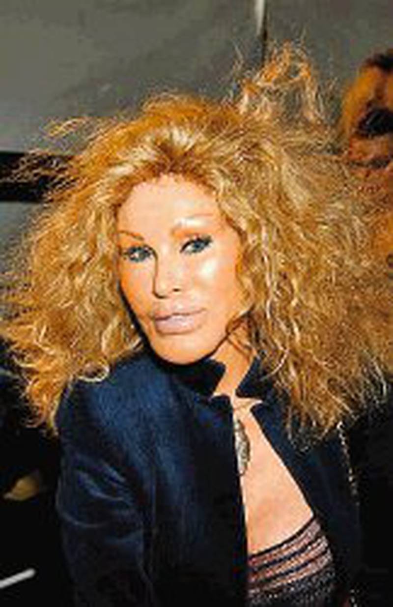 Reina de las cirugías en la lista de las más feas | La Nación