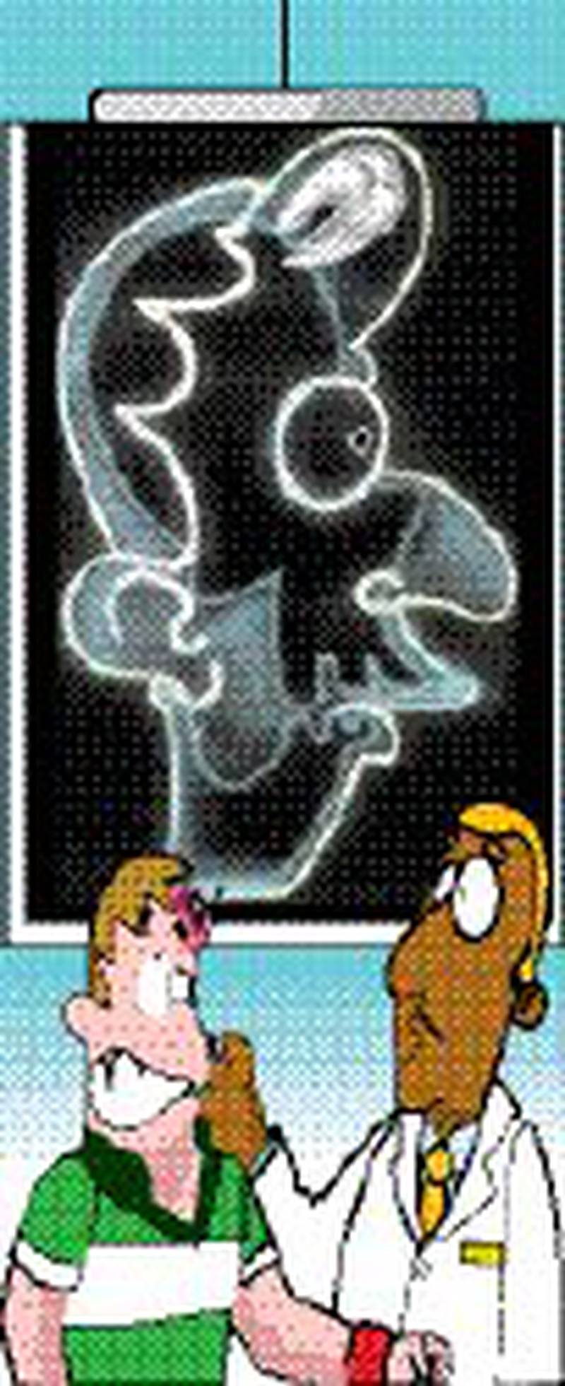 El diente de un rival era la causa de su jaqueca | La Nación