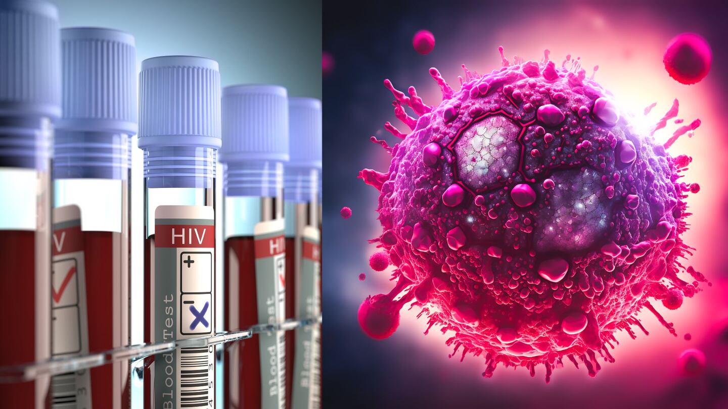 Cómo se transmite el VIH: Mitos y realidades | La Nación