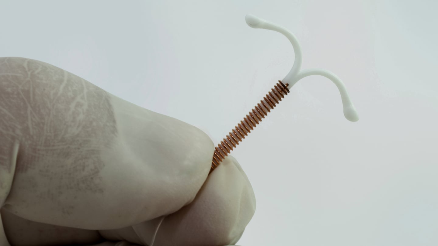 Madre queda embarazada con DIU y bebé nace con dispositivo adherido al ...