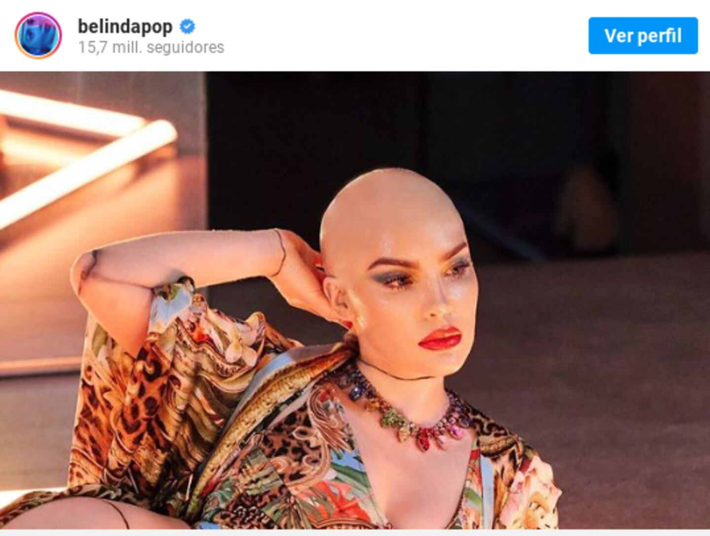 Belinda aparece sin cabello en redes sociales | La Nación