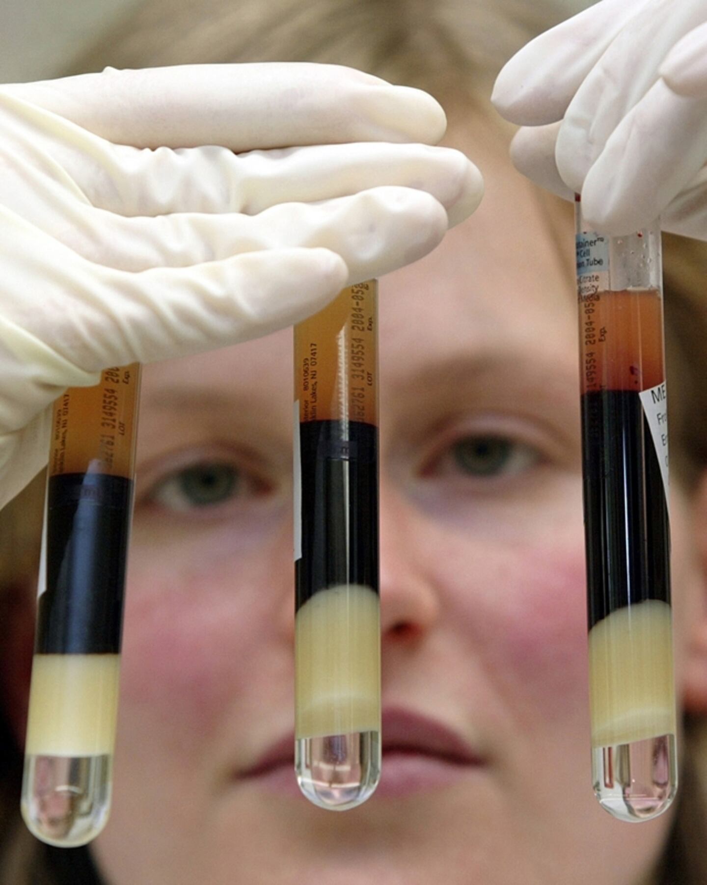 Desarrollan sustancia contra el sida de eficacia duradera en los monos ...