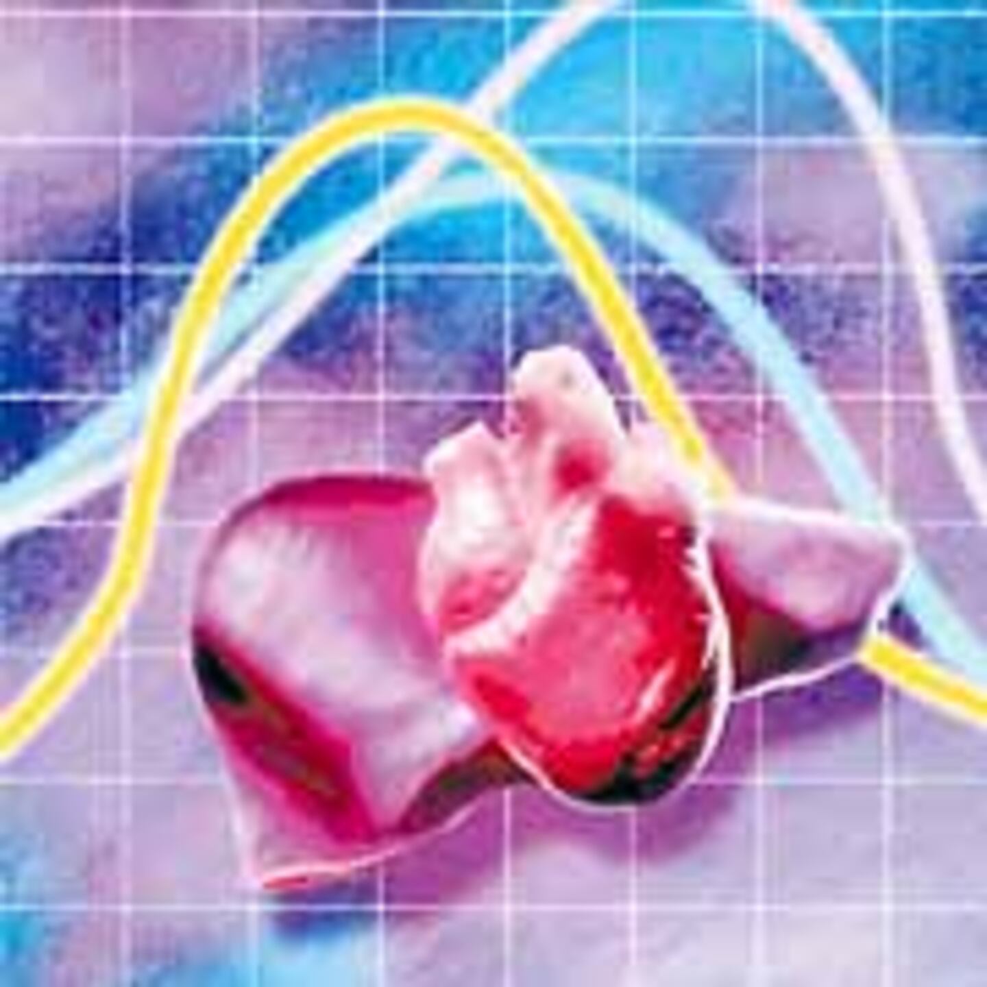 Al rescate del corazón infartado | La Nación